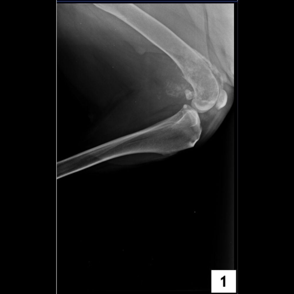 Stereotactic Radiotherapy Treatment In A Dog With Appendicular ...